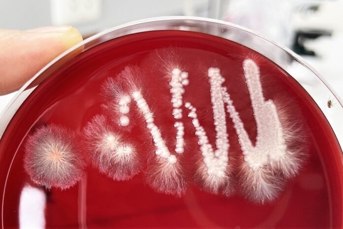 Tutto quello che c'è da sapere sulla candida in gravidanza | BlaBlaMamma.it